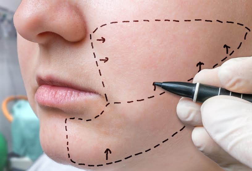 Lipofilling Facial con el Dr. Candau - Maxilofacial | Córdoba, Madrid